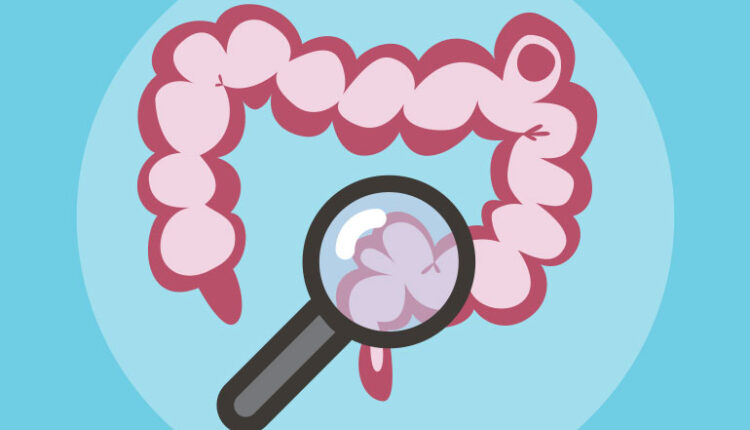 Best Colon Health Tips To Keep You Healthy - My 247 Magazine - Get ...